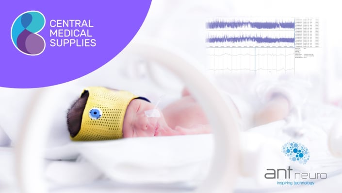 nëo™ Neonatal Brain Monitor Now with Viewlite Software - Central ...